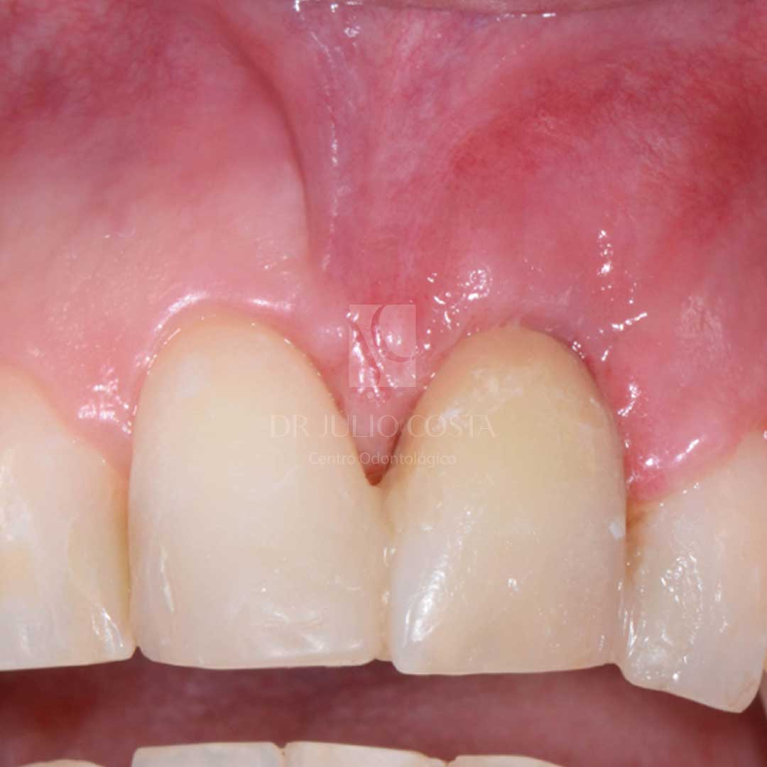 Periodontia - Dr. Julio Costa