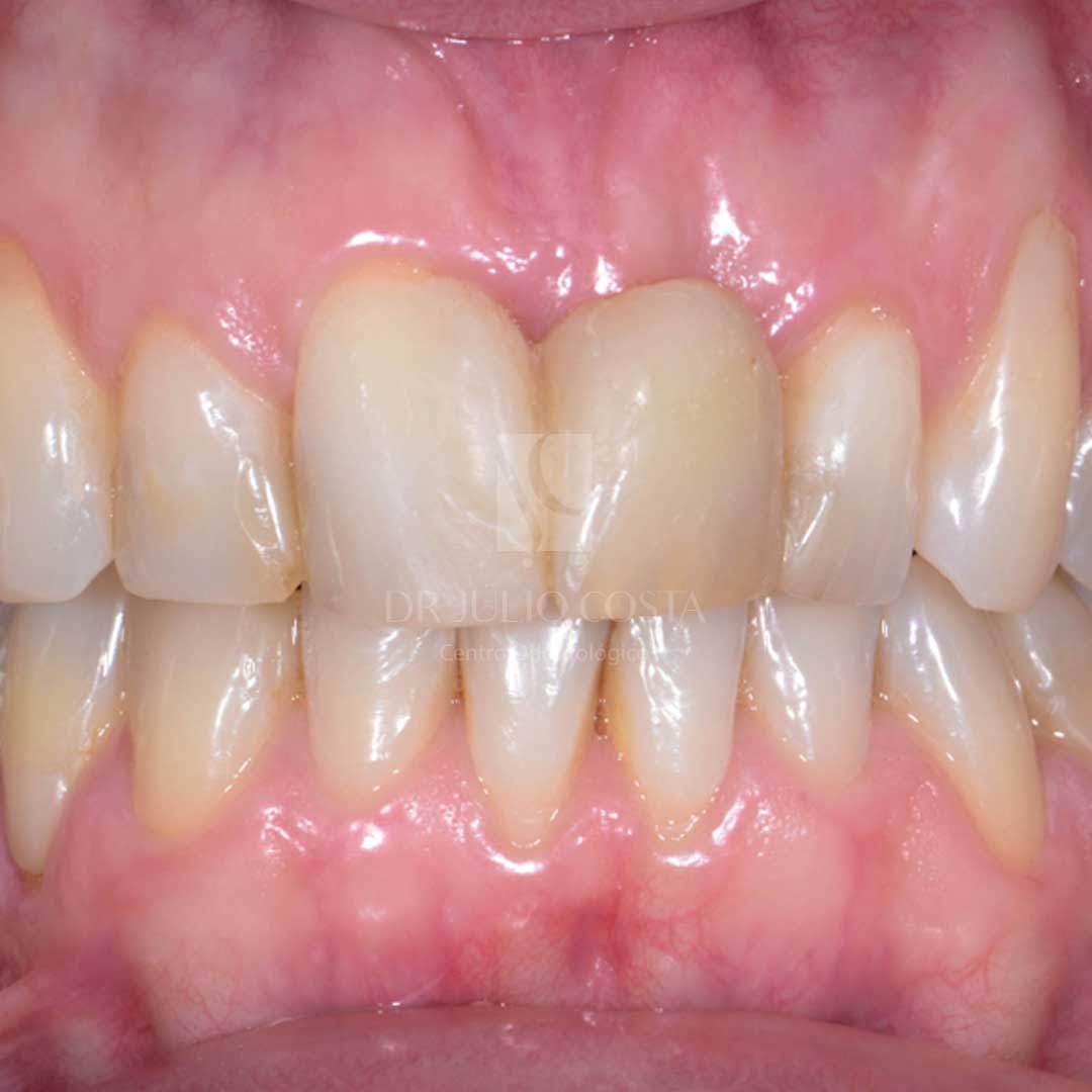 Periodontia - Dr. Julio Costa